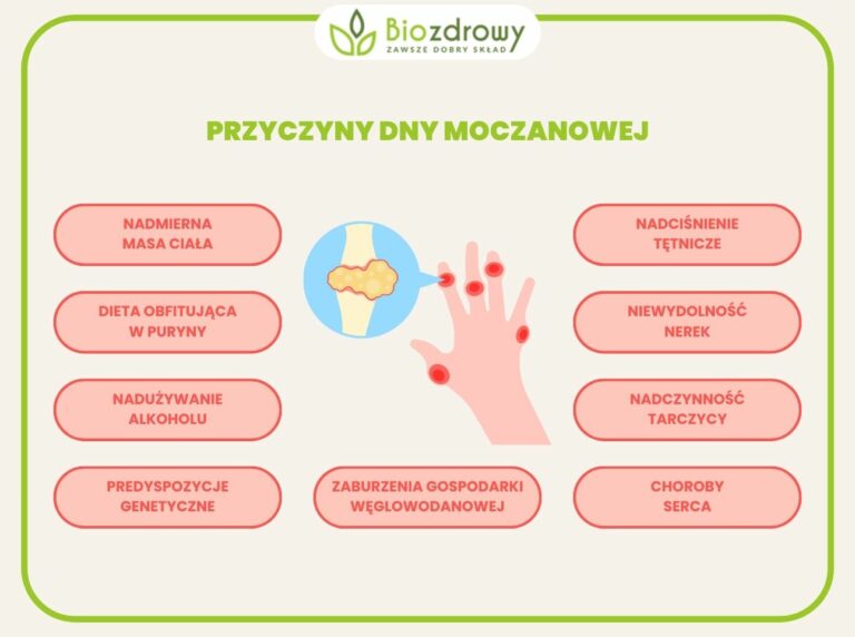 Dna moczanowa - objawy, profilaktyka i dieta - Strefa Wiedzy Biozdrowy